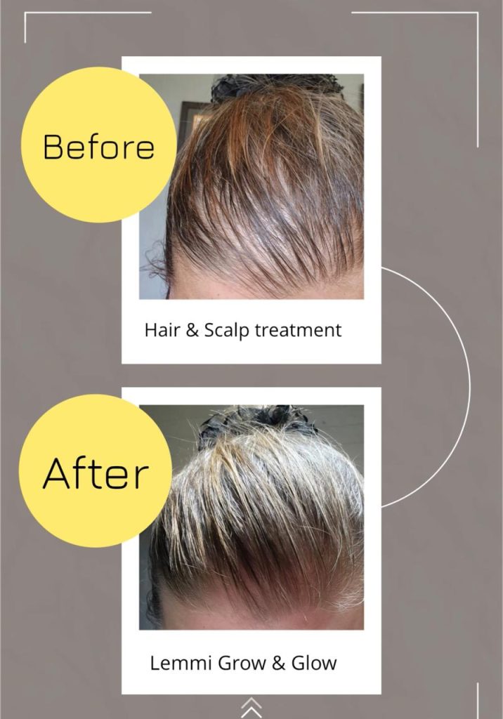 Lemmi - Grow & Glow - Lemmi Lifestyle